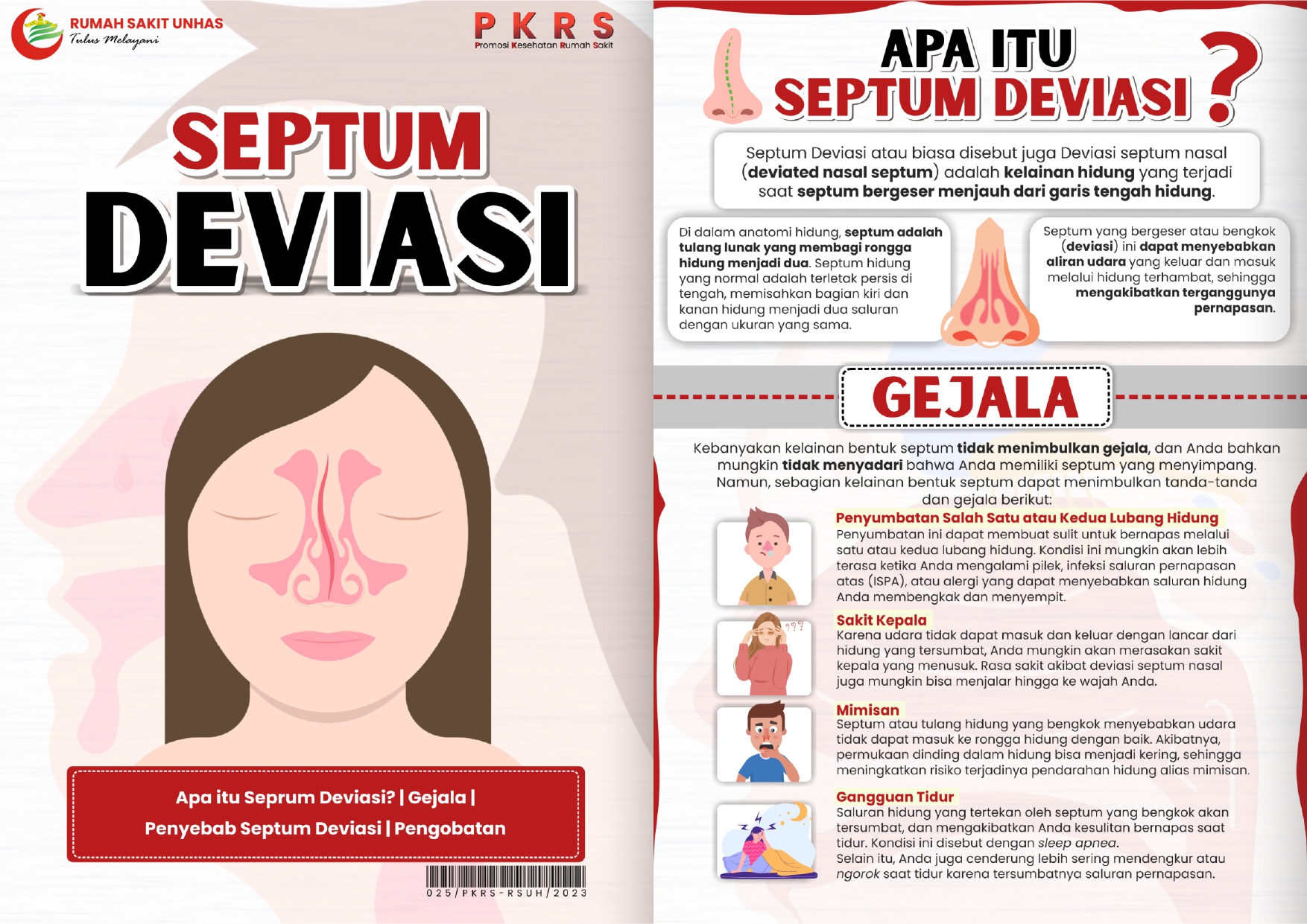 Septum Deviasi – Rumah Sakit Unhas